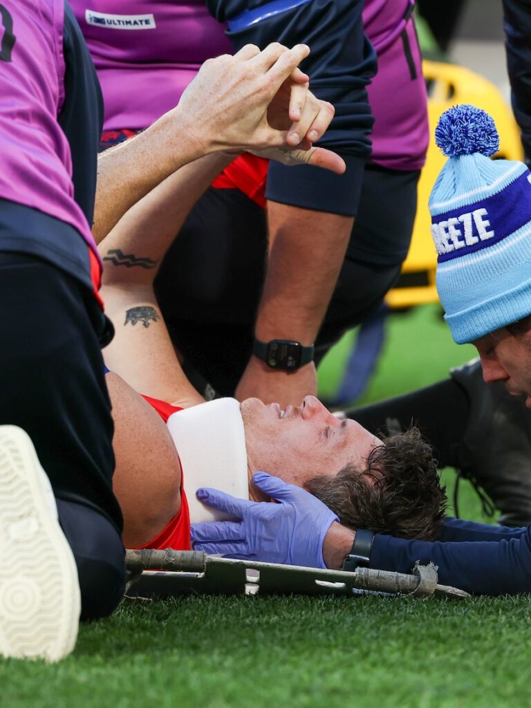 Mihocek ‘up and walking’ after surgery on neck fracture – The World News